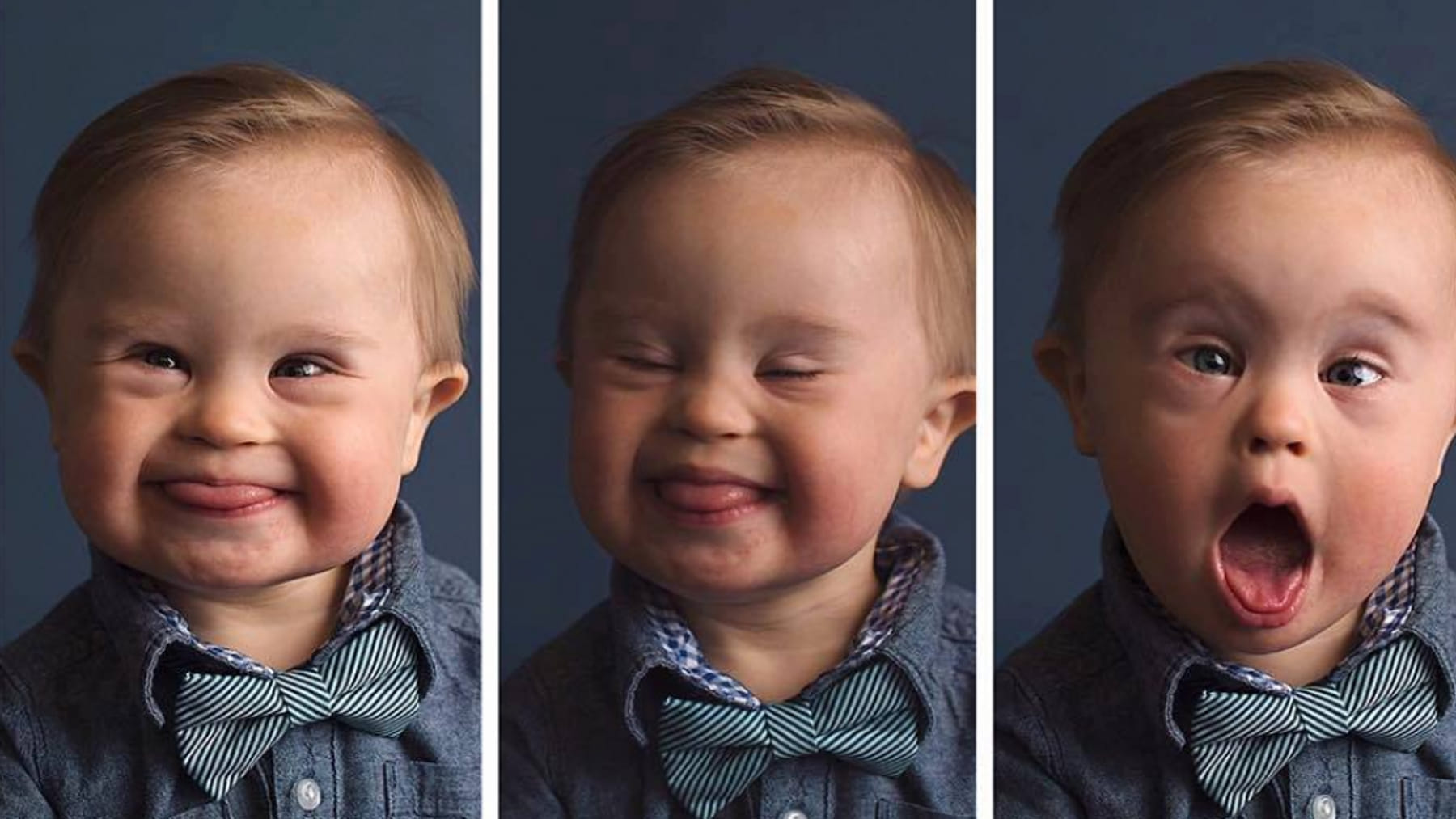 Kindje met syndroom van Down afgewezen door modellenbureau - EO